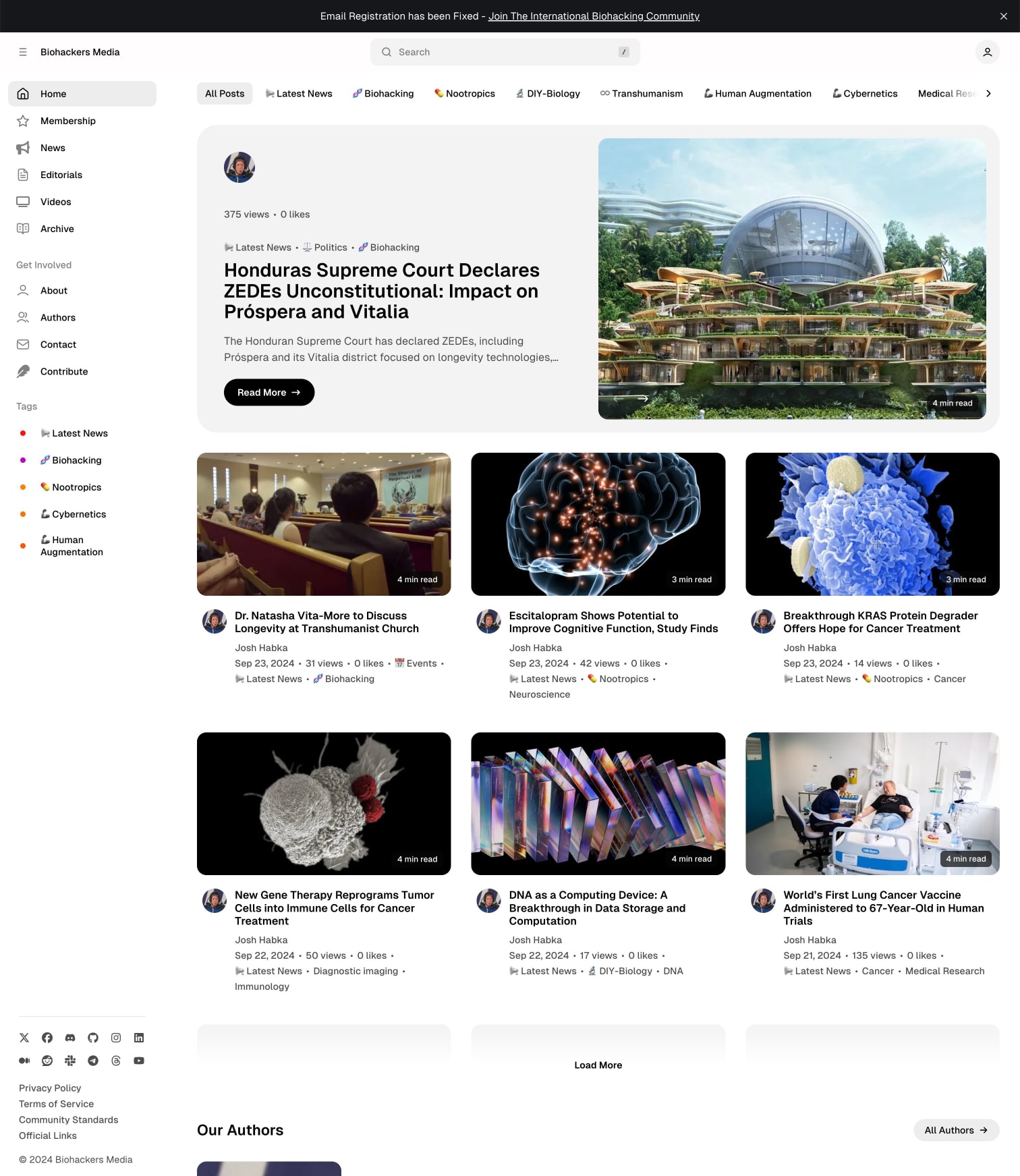 Showcase of Aspect theme – Priority Vision